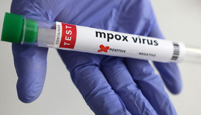 World Health Organization okays first Mpox diagnostic test - Daily Ausaf