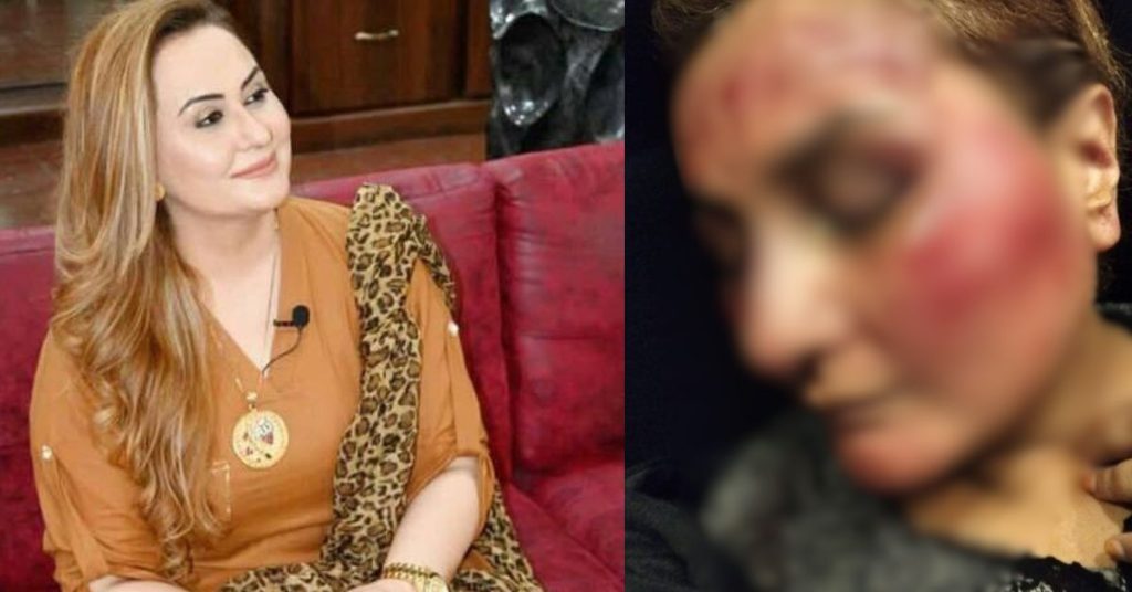 Pakistani actress Nargis allegedly tortured by husband - Daily Ausaf